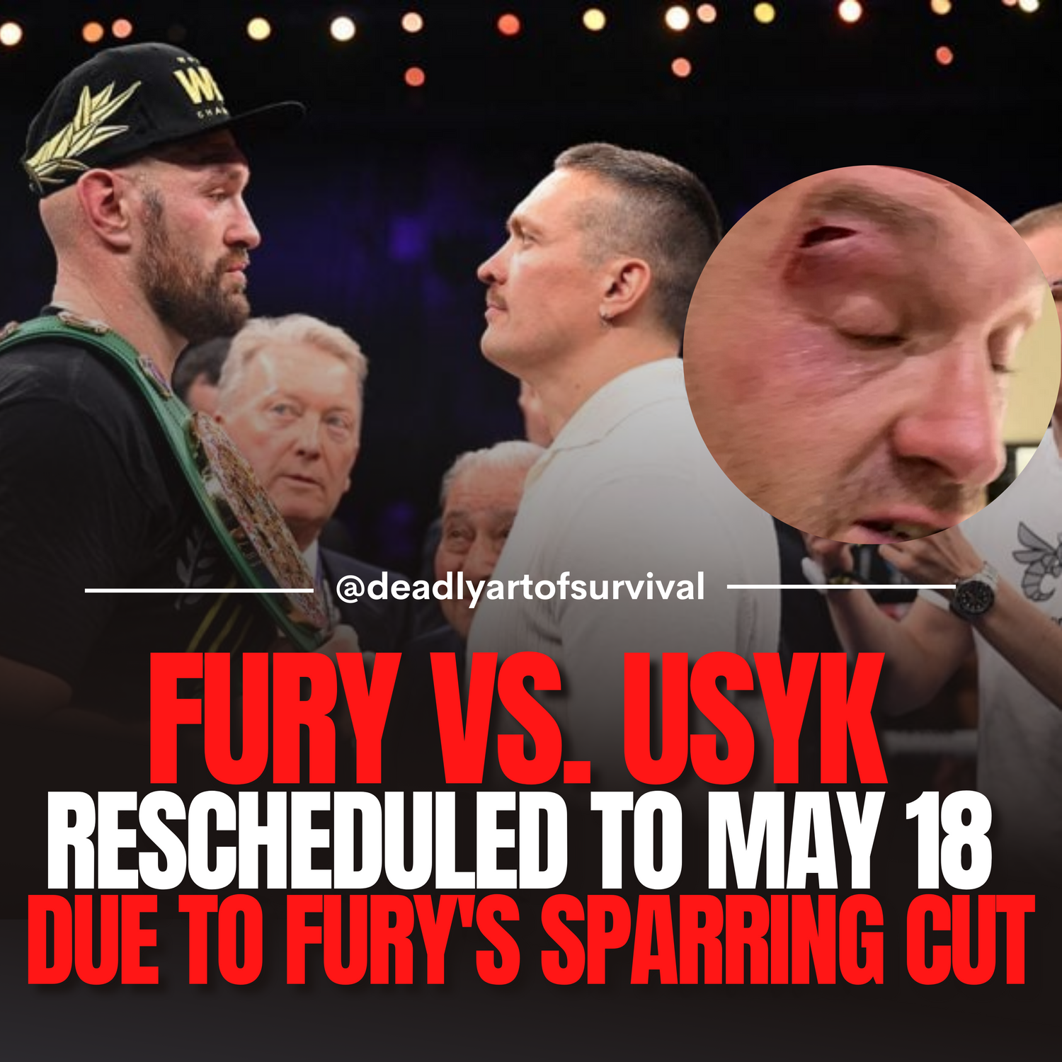 Fury vs. Usyk Rescheduled: May 18 Clash Set After Fury's Sparring Cut ...