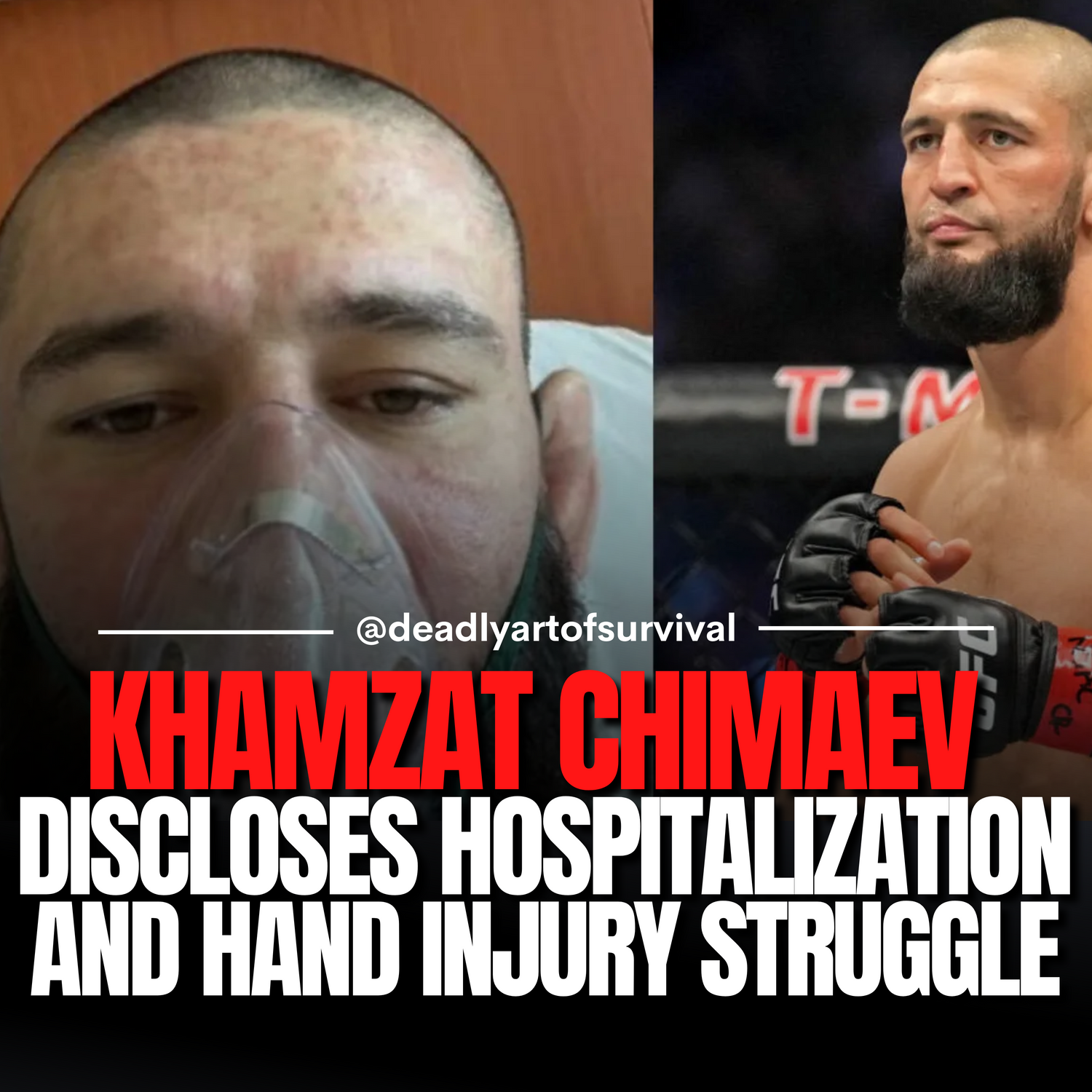 Khamzat Chimaev Opens Up: Hospitalized and Battling Hand Injury ...